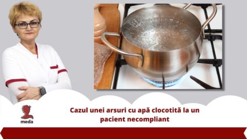 Arsura de gradul 3 cu apa clocotita la o pacienta necomplianta